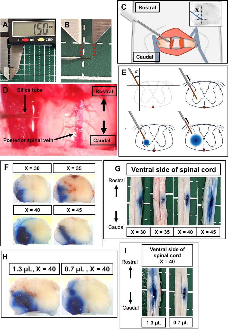 New rat model of spinal cord infarction with long-lasting functional ...